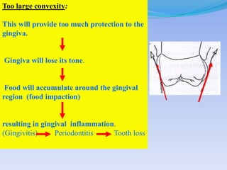 Physiologic tooth form part 2 | PPTX