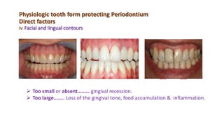 Physiologic tooth from I | PPTX