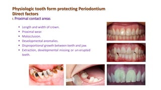 Physiologic tooth from I | PPTX