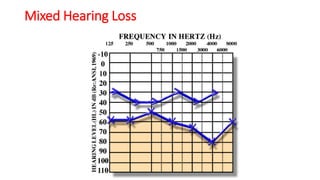Physiology of Hearing | PPT