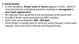 Cardiac Arrhythmias Physiology and ECG changes | PPT