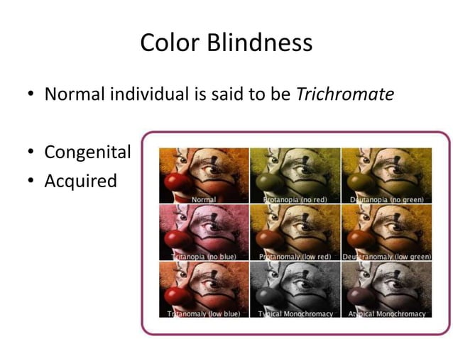 Physiology of colour vision | PPTX