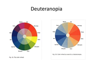 Physiology of colour vision | PPTX