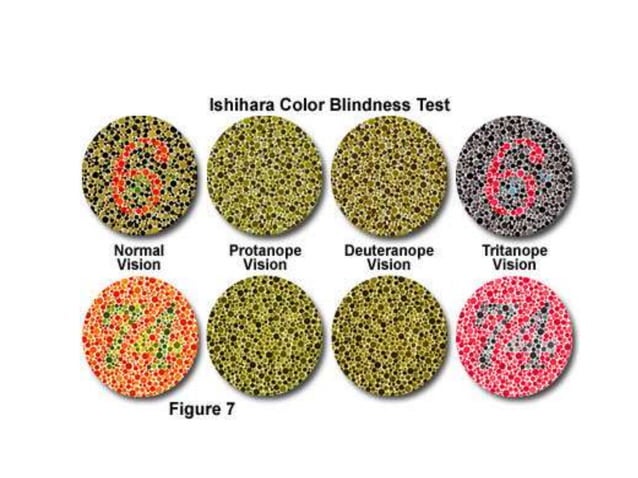 Physiology of colour vision | PPTX