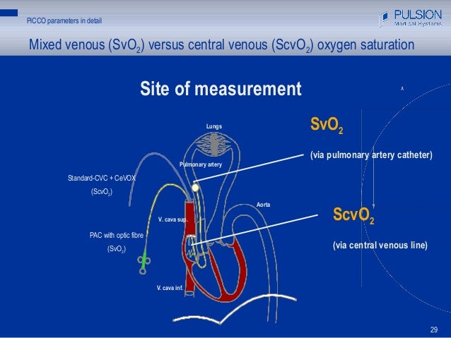 Physiology of hemodynamics & PiCCO parameters in detail