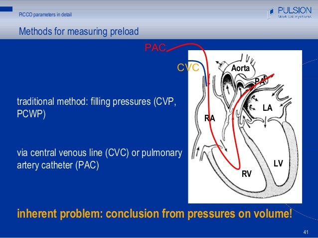 Physiology of hemodynamics & PiCCO parameters in detail