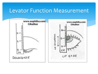 Physiology of the Eyelids and Lacrimal Pump/ Methods of Examination | PPTX