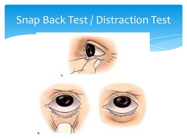Physiology of the Eyelids and Lacrimal Pump/ Methods of Examination