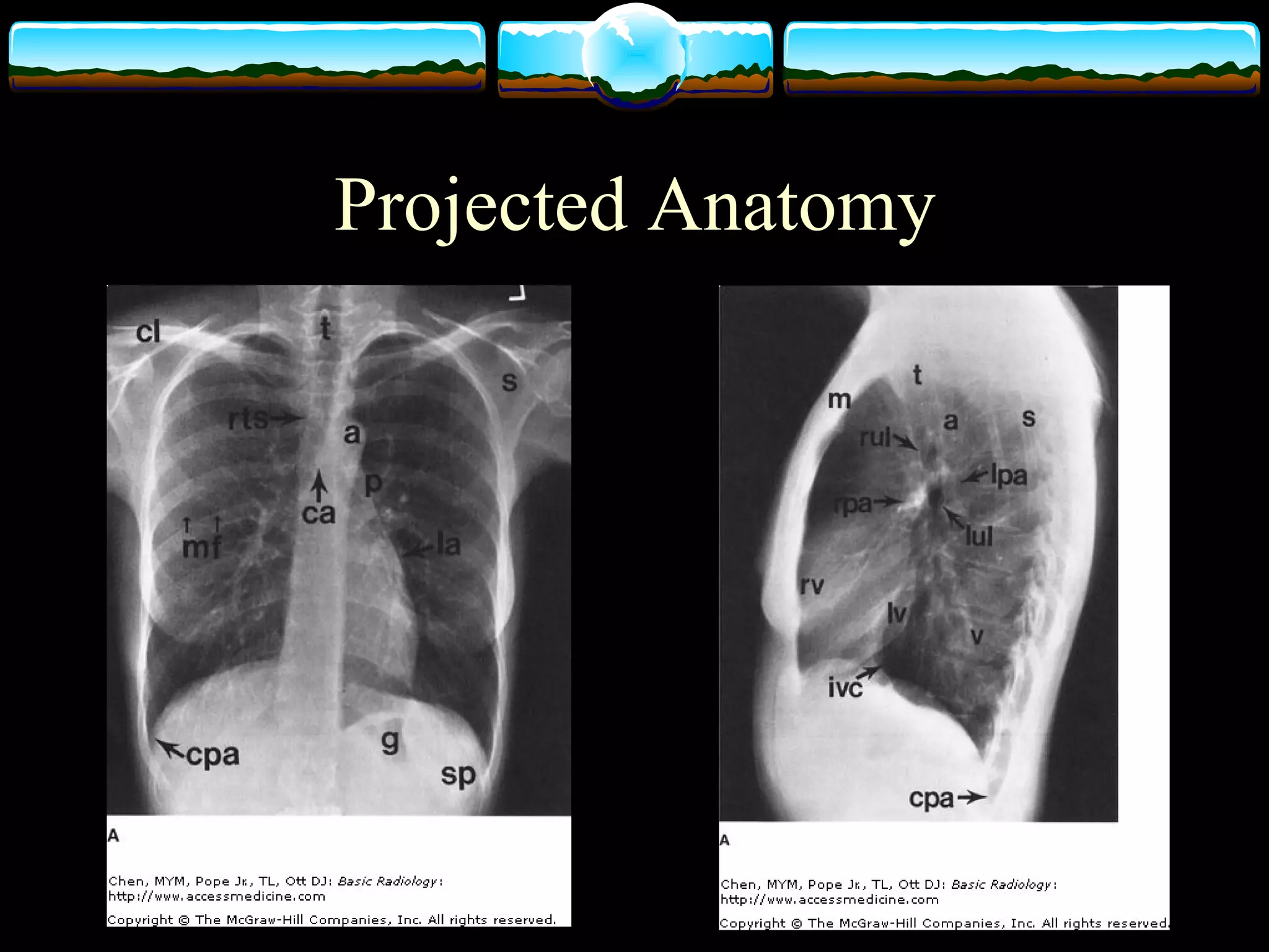 Physiology of Chest X-Ray | PPT