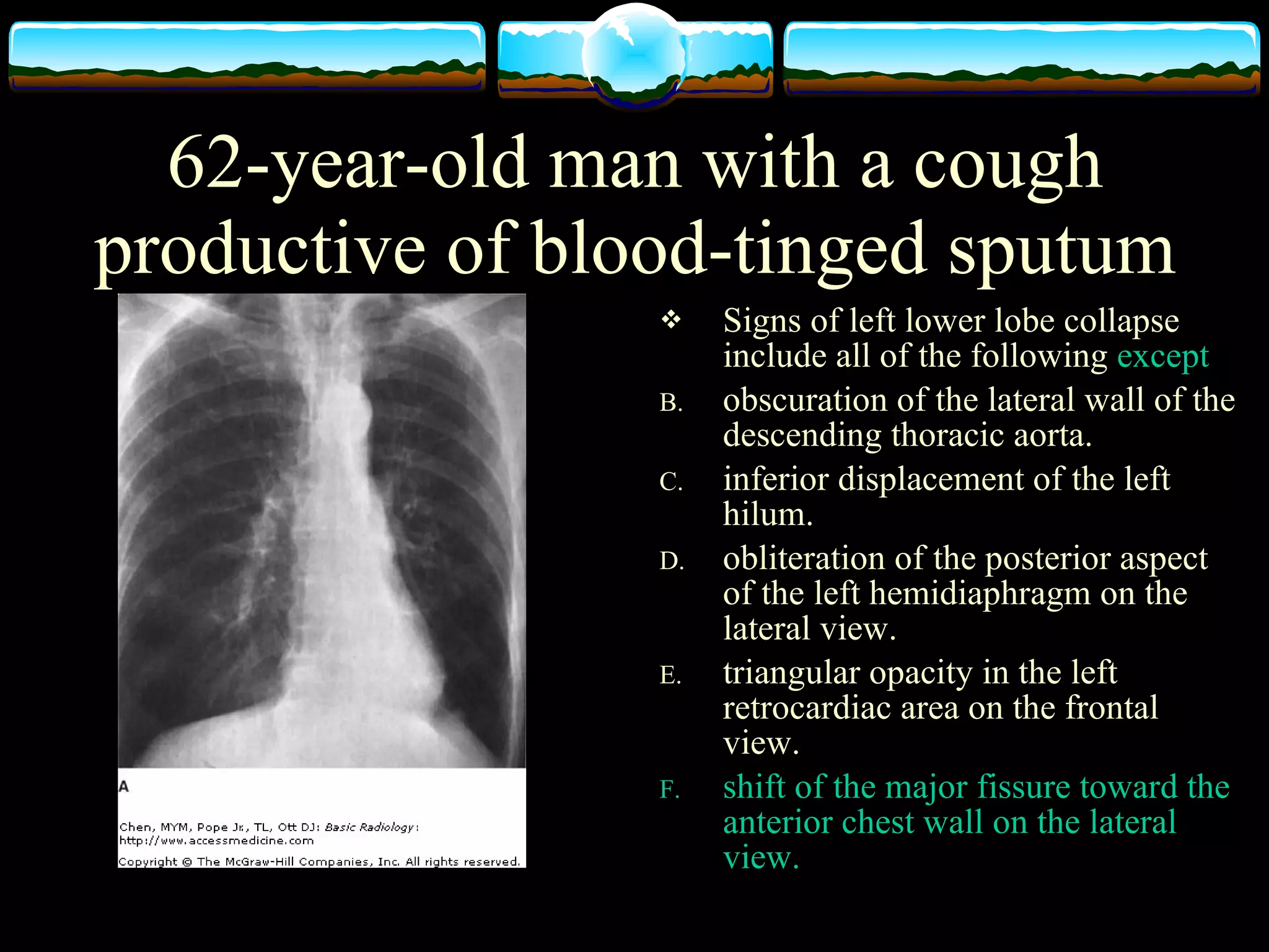 Physiology of Chest X-Ray | PPT