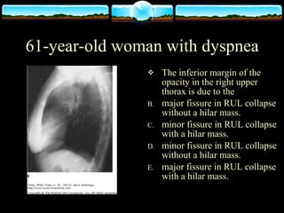 Physiology of Chest X-Ray | PPT