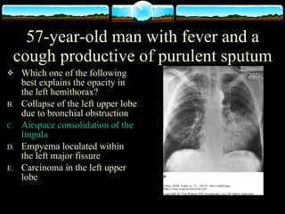 Physiology of Chest X-Ray | PPT