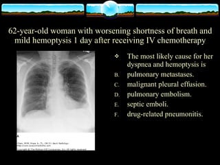 Physiology of Chest X-Ray | PPT