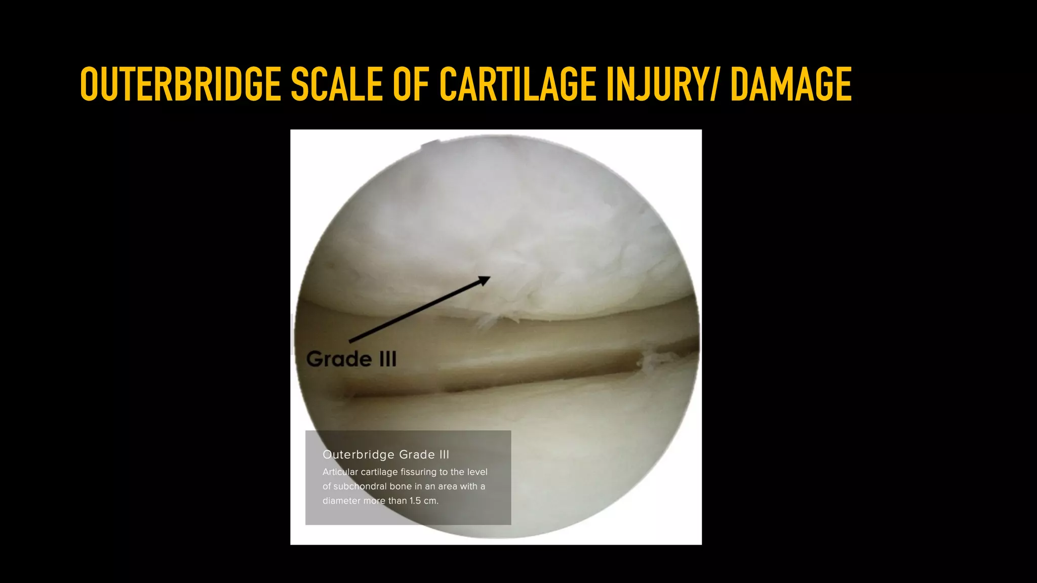 PHYSIOLOGY OF CARTILAGE, COLLAGEN, TENDON, MUSCLE.pdf
