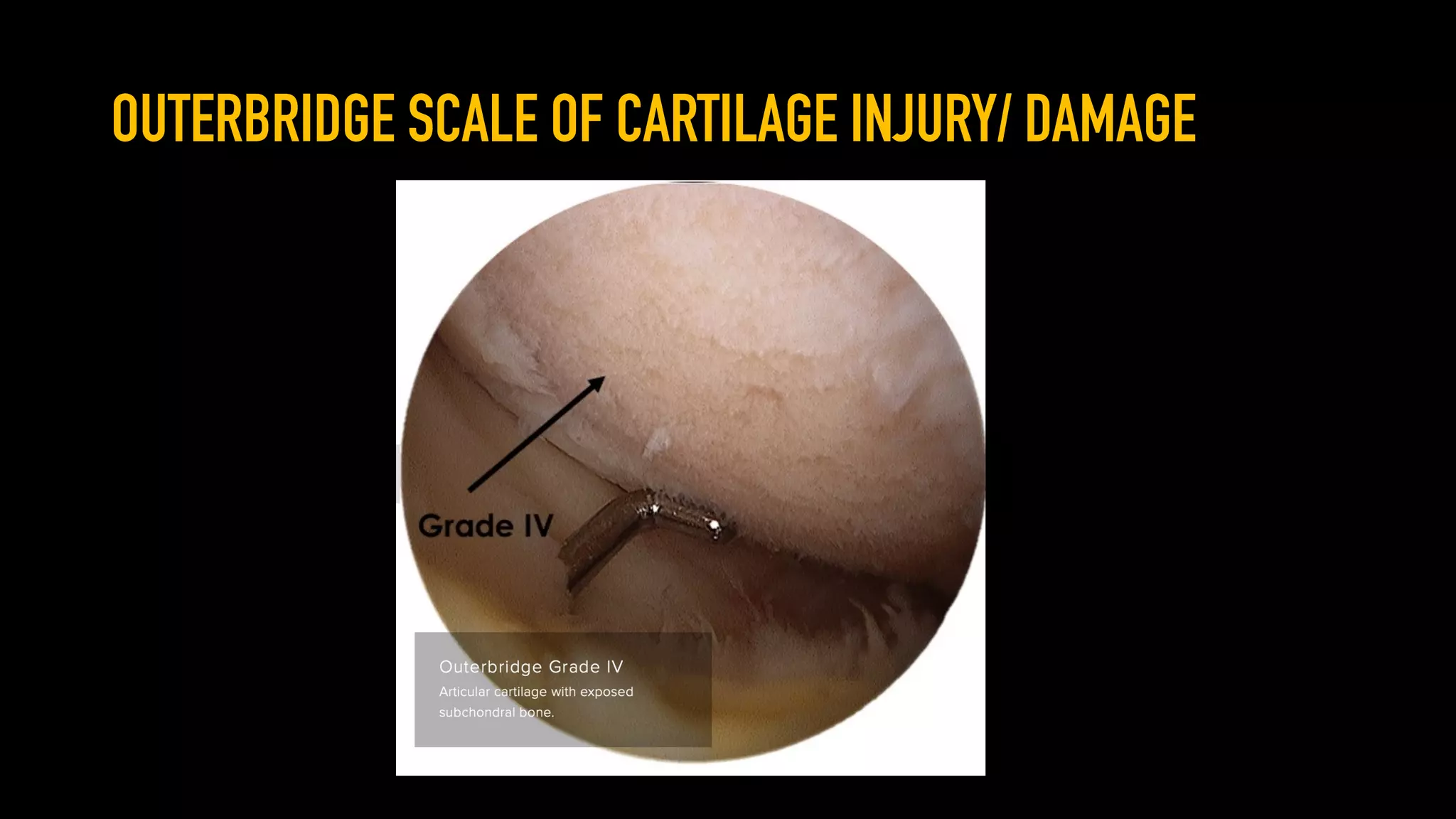 PHYSIOLOGY OF CARTILAGE, COLLAGEN, TENDON, MUSCLE.pdf