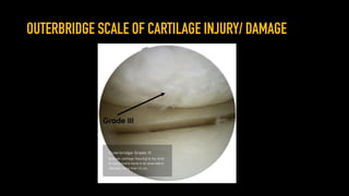 PHYSIOLOGY OF CARTILAGE, COLLAGEN, TENDON, MUSCLE.pdf