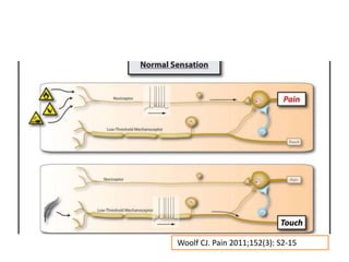 Basics of Chronic Pain - Dr Venugopal Kochiyil | PPT