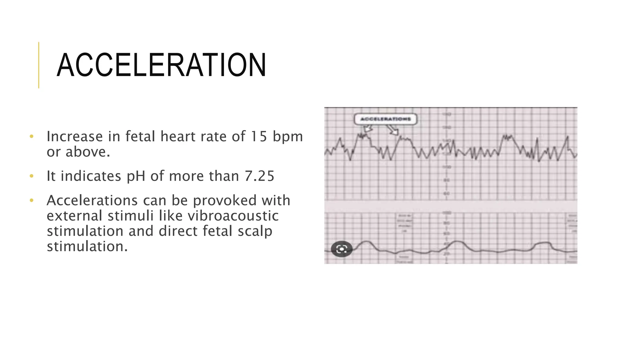PHYSIOLOGY OF DOING CTG gynaecology.pptx