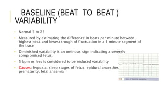 PHYSIOLOGY OF DOING CTG gynaecology.pptx