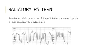 PHYSIOLOGY OF DOING CTG gynaecology.pptx