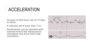 PHYSIOLOGY OF DOING CTG gynaecology.pptx