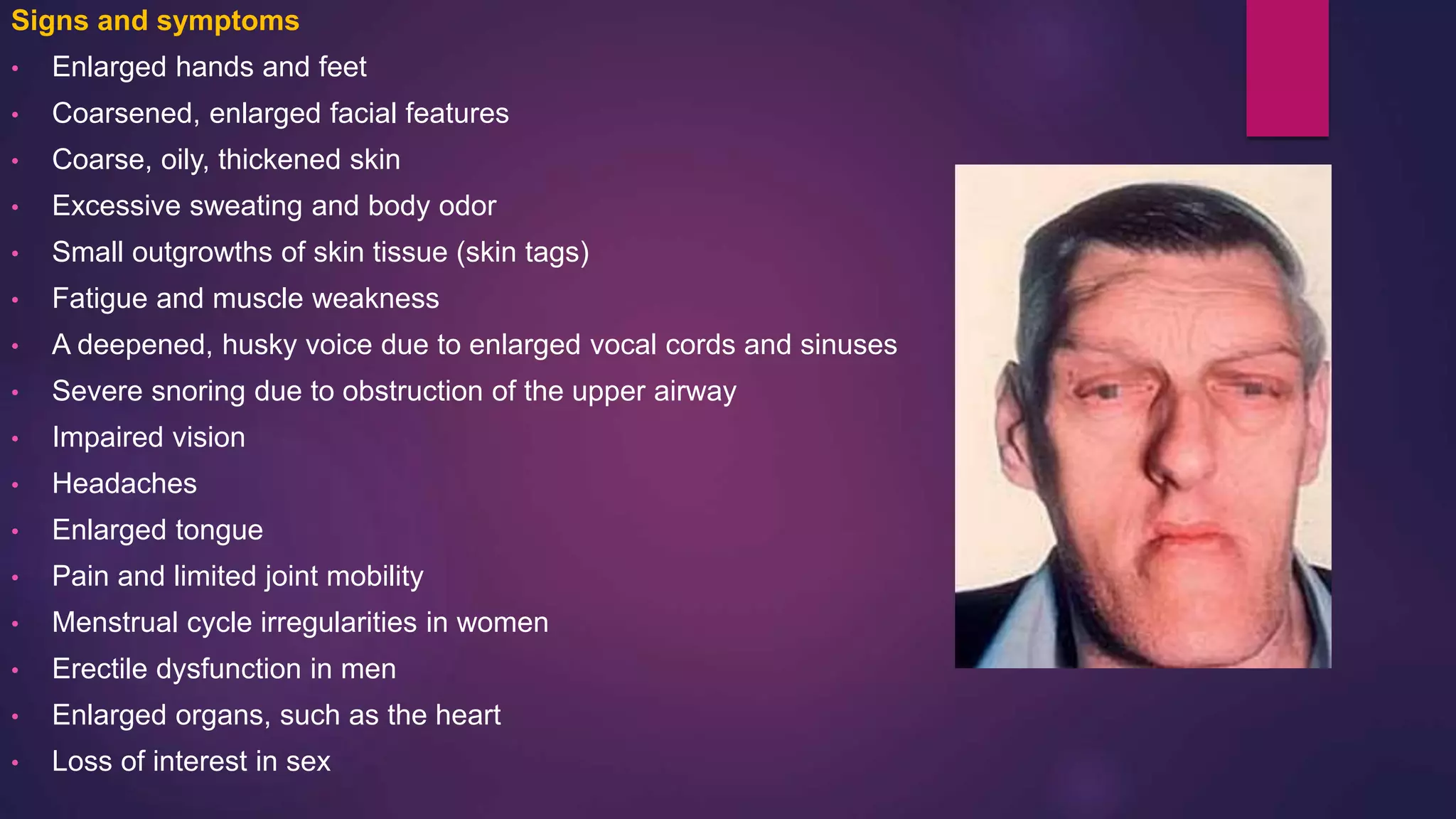 Physiology Of Pituitary Gland Ppt