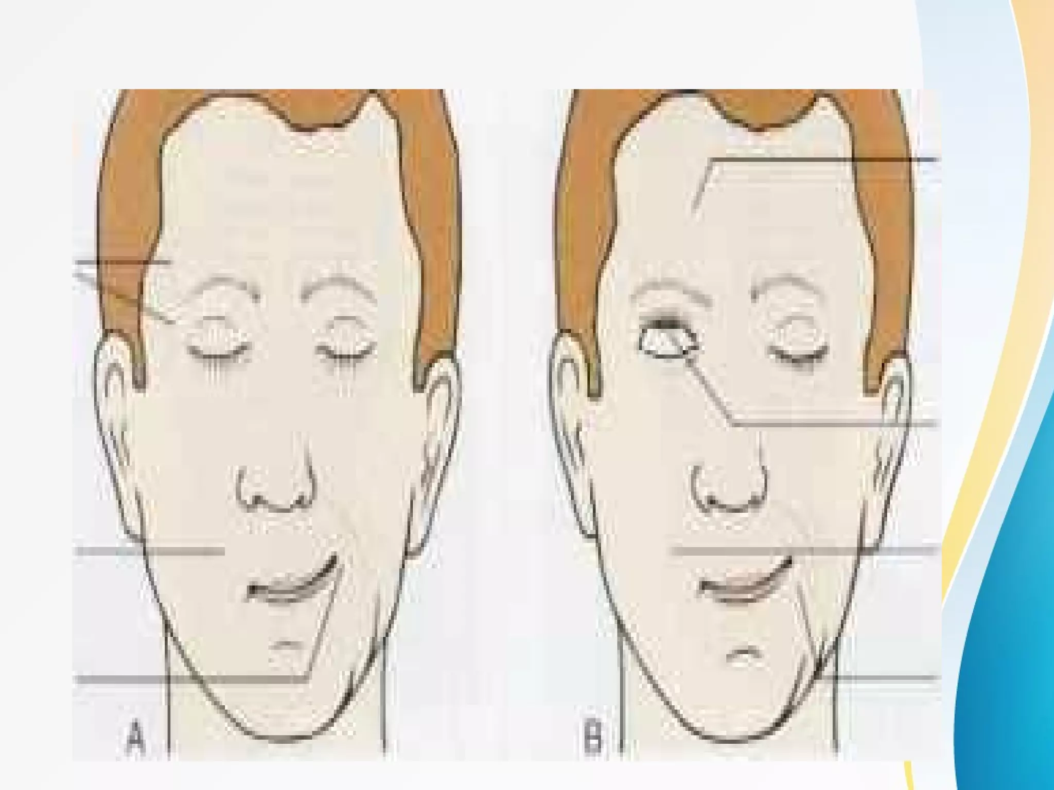 Physiology of eyelids and eyebrows | PPT