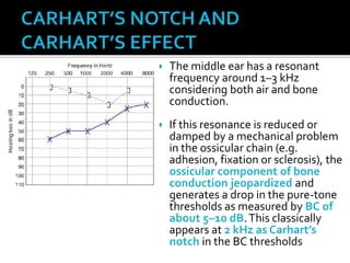 PHYSIOLOGY OF HEARING-ARNAV.pptx