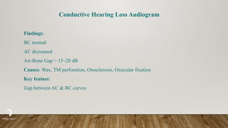 Comprehensive Physiology of Hearing and Audiology: Mechanisms, Tests ...