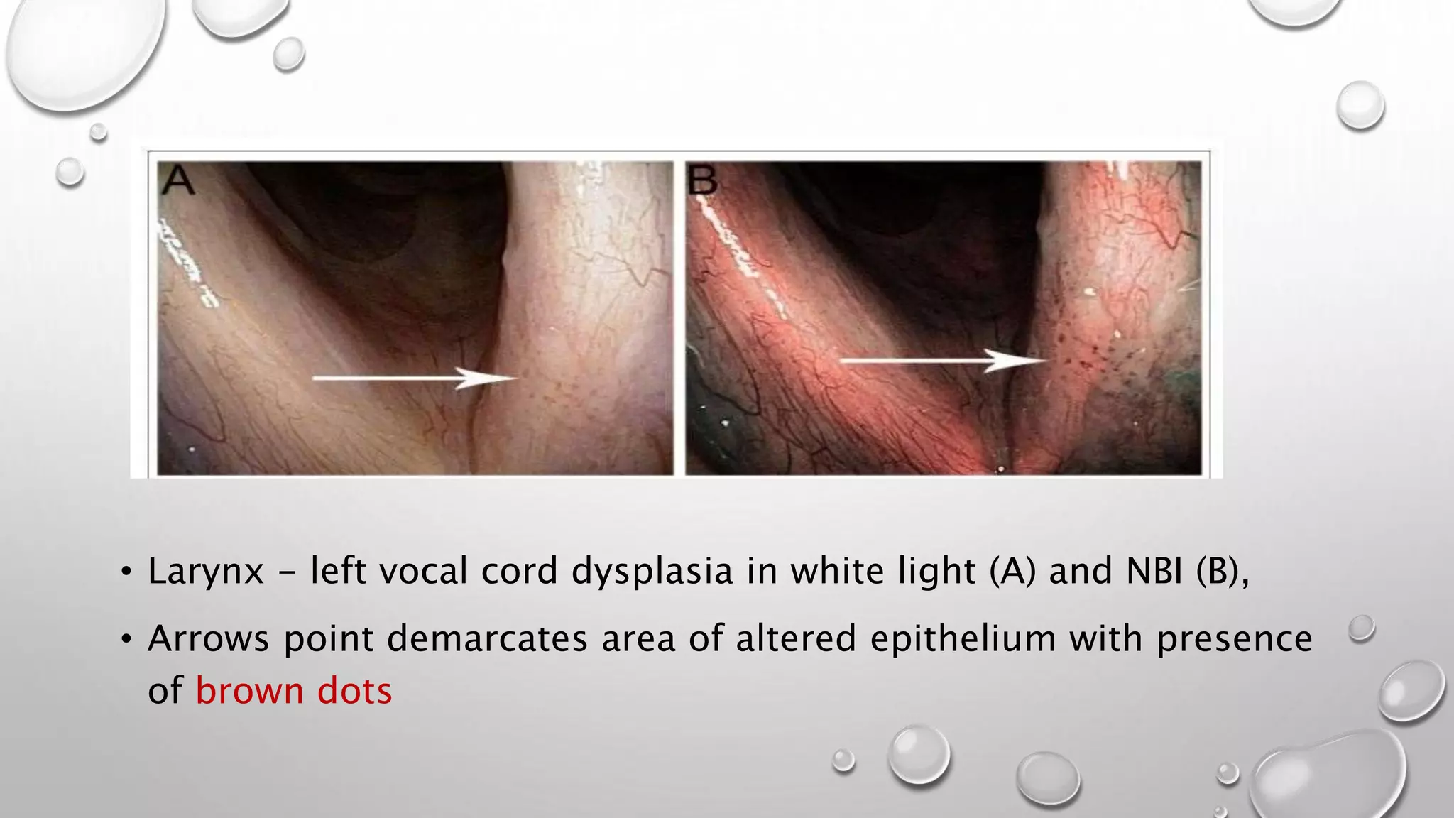 Physiology of larynx AND assessment of laryngeal function | PPTX