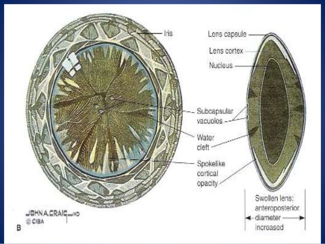 Physiology of lens and cataractogenesis