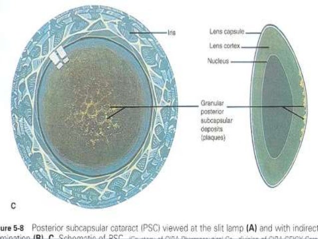 Physiology of lens and cataractogenesis