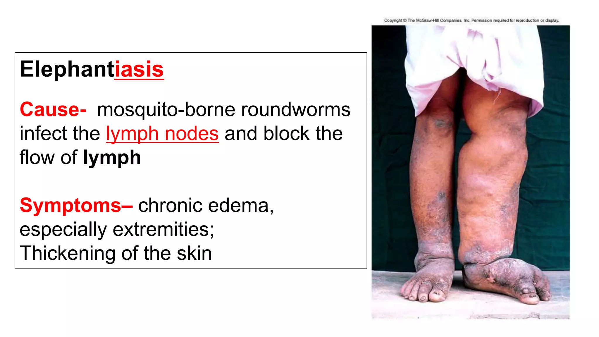 physiology of lymphatic and immune system.ppt