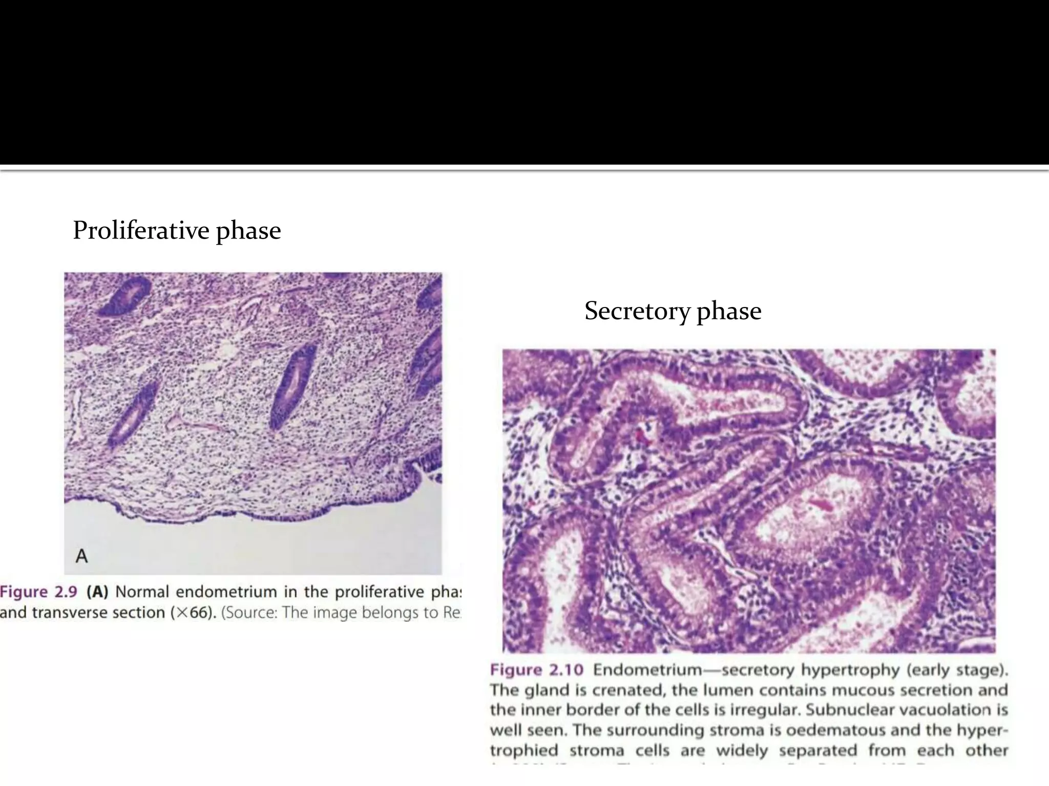 physiology of menstruation litty ppt.pptx