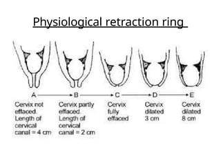 Physiology of normal labour by Saloni Patel.pptx