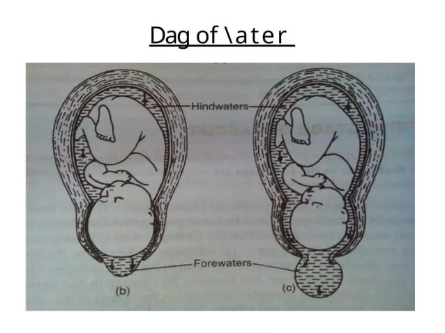 Physiology of normal labour by Saloni Patel.pptx