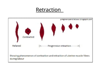 Physiology of normal labour by Saloni Patel.pptx
