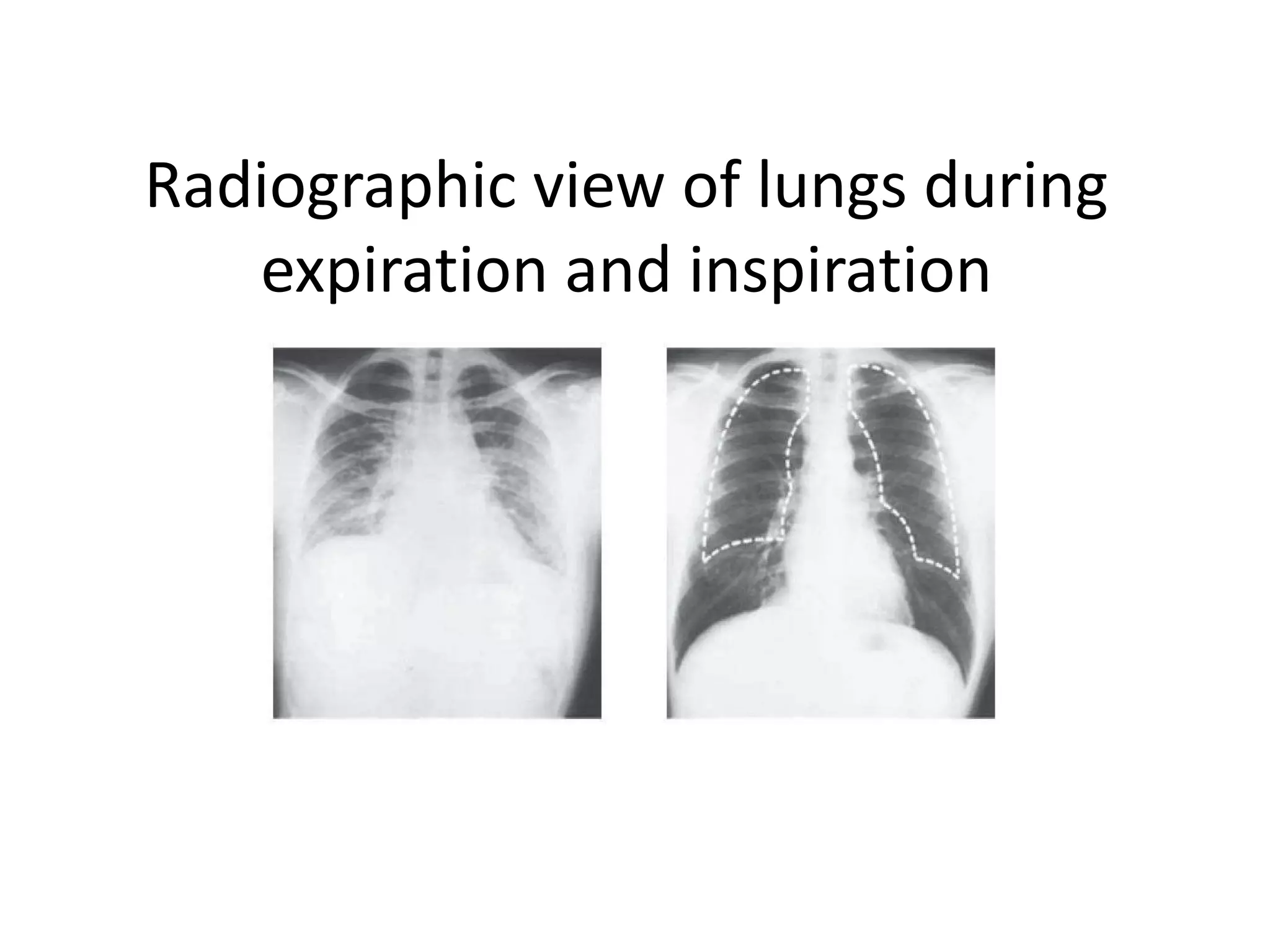 Physiology of respiration | PPTX