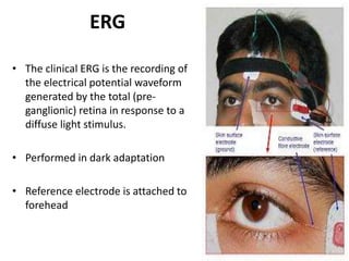 PHYSIOLOGY OF RETINA.pptx