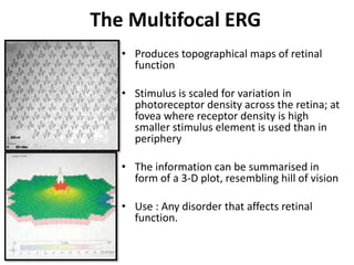 PHYSIOLOGY OF RETINA.pptx
