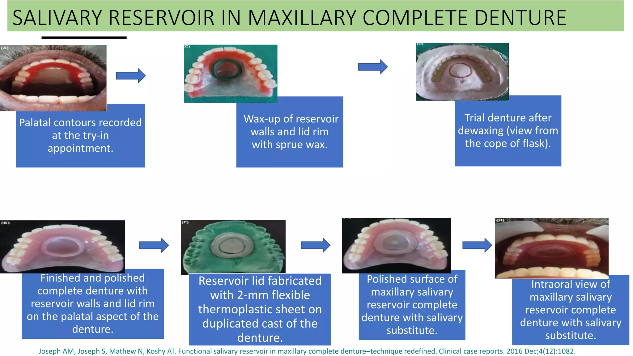 PHYSIOLOGY OF SALIVA AND ITS SIGNIFICANCE IN PROSTHODONTICS.pptx