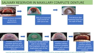 PHYSIOLOGY OF SALIVA AND ITS SIGNIFICANCE IN PROSTHODONTICS.pptx