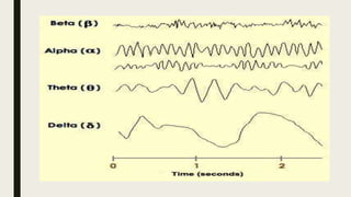 Physiology of sleep | PPTX