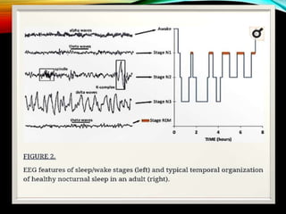 Physiology of sleep - medical information | PPTX