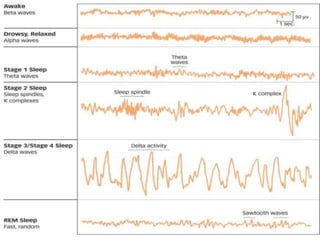 PHYSIOLOGY OF SLEEP.pptx
