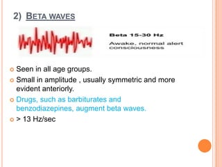 Physiology of sleep and E.E.G for undergraduates | PPTX