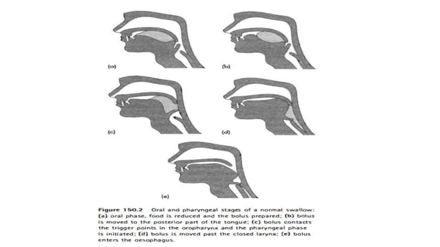 Physiology of swallowing | PPTX | Ear, Nose and Throat Conditions ...