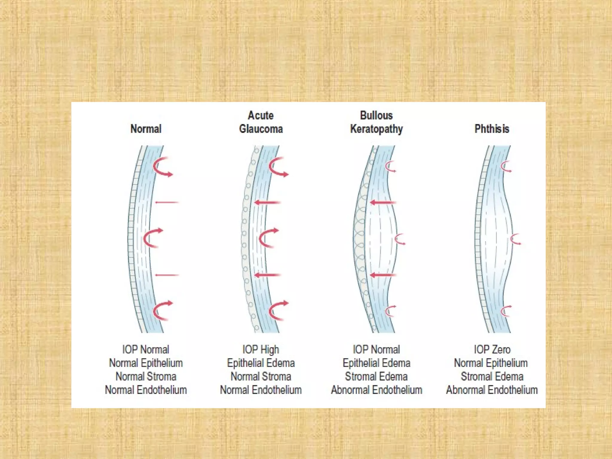 Physiology of the cornea | PPT