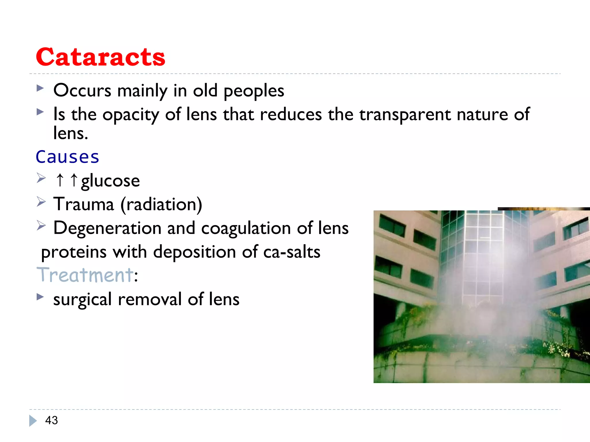 Physiology of the eye | PPT