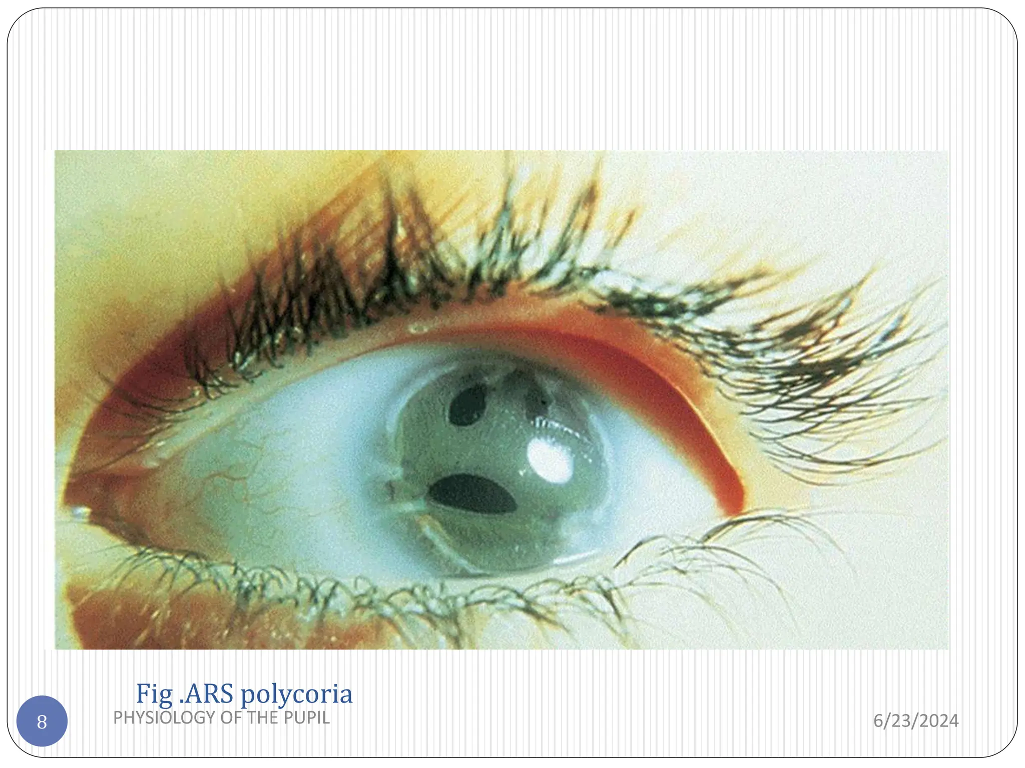 studies of PHYSIOLOGY OF THE PUPIL.pptx